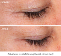 Magic wand|QUASAR MD PLUS |Your Summer Skincare Duo – QuasarMD - Quasar ...