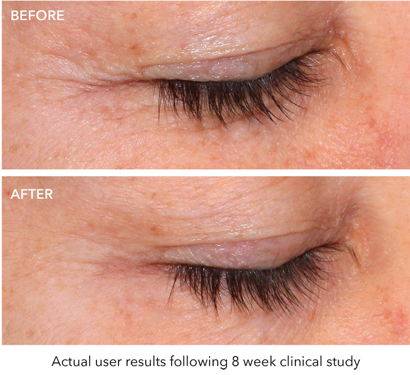 Magic wand|QUASAR MD PLUS |Your Summer Skincare Duo – QuasarMD - Quasar ...